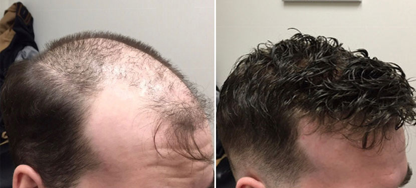 Services – Base line Hair